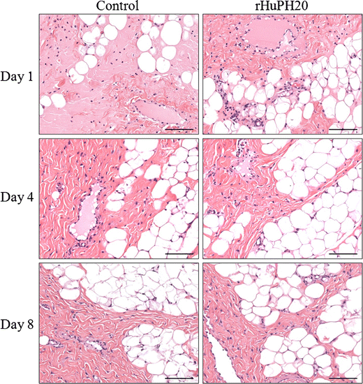 Recombinant human hyaluronidase PH20 (rHuPH20) facilitates subcutaneous ...