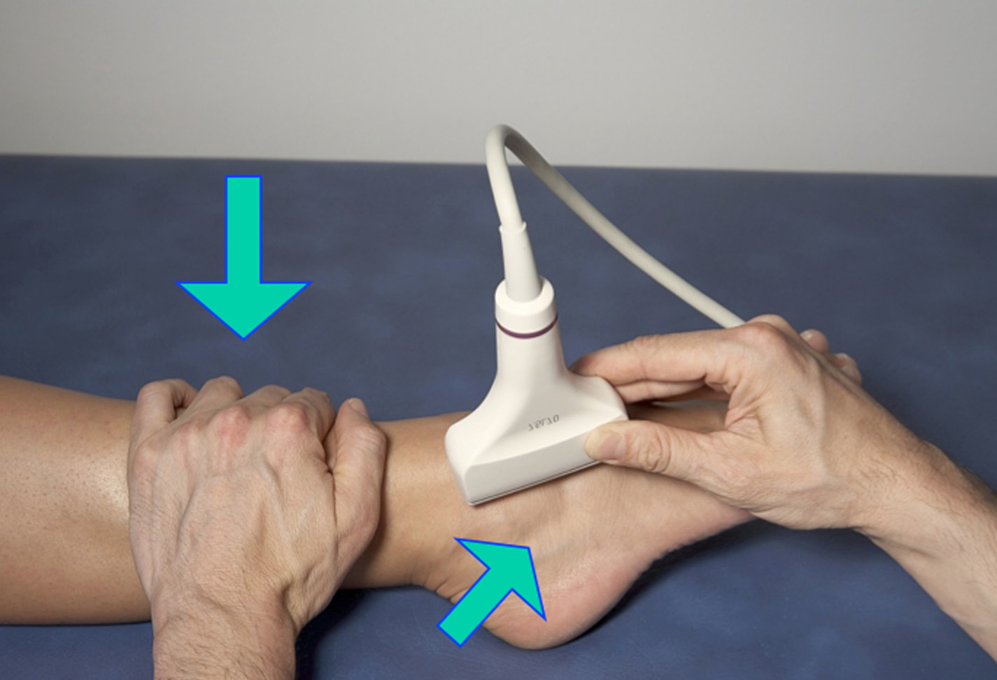 Sonografische Diagnostik an Sprunggelenk und Fuß | SpringerLink
