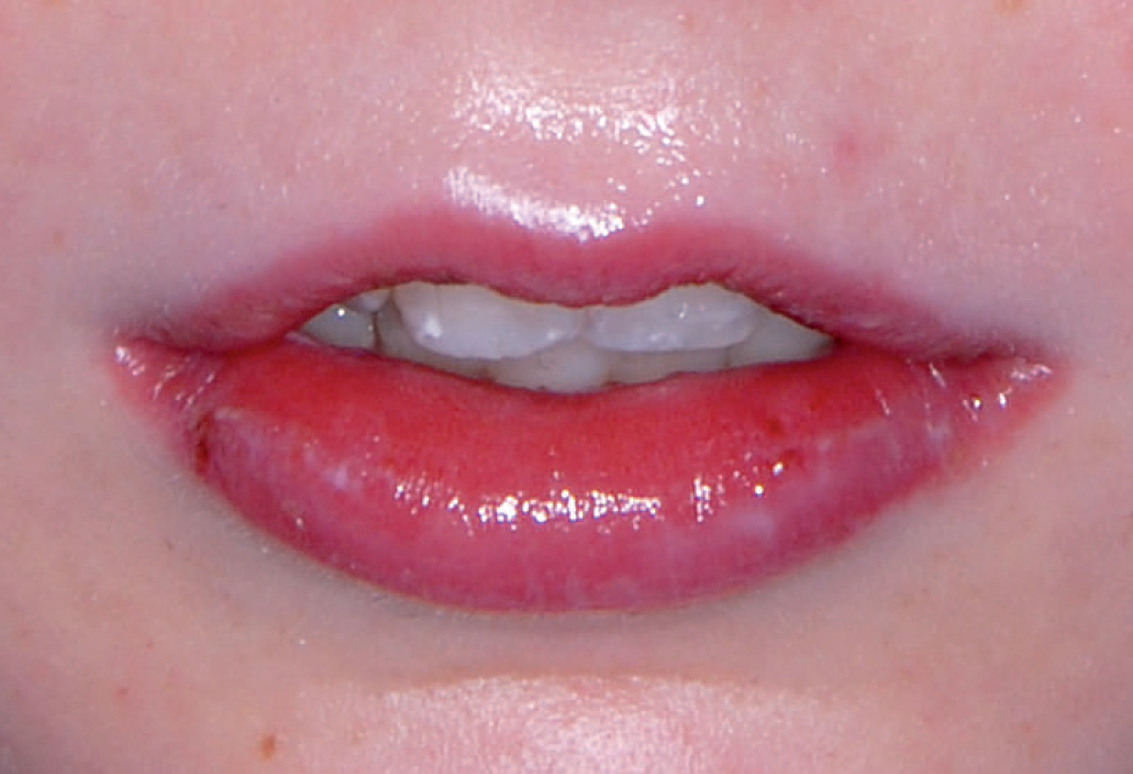 Harmlos oder Ernstfall? So klären Sie das abImpfungen | SpringerLink