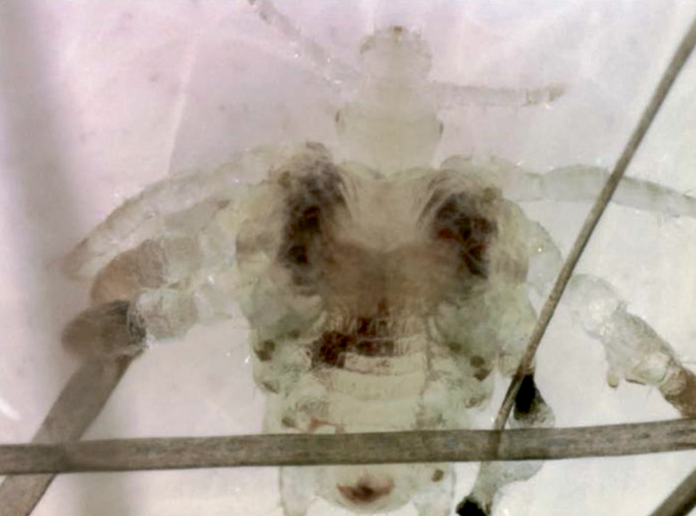 Eine richtig lausige Diagnose | SpringerLink