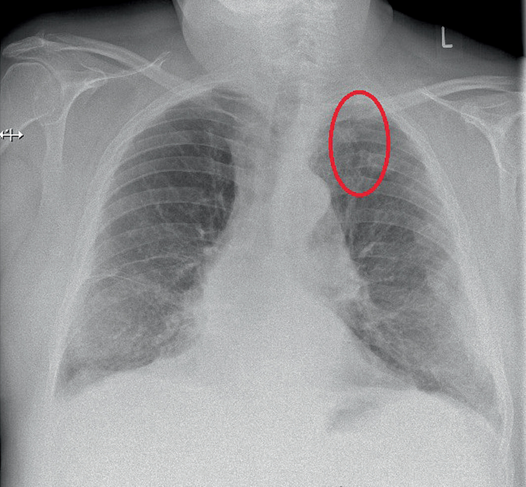 „Es knackt so beim Atmen“ | SpringerLink