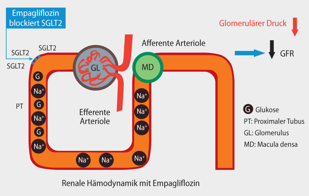 Gliflozin bei Diabetes schützt auch Nieren | SpringerLink
