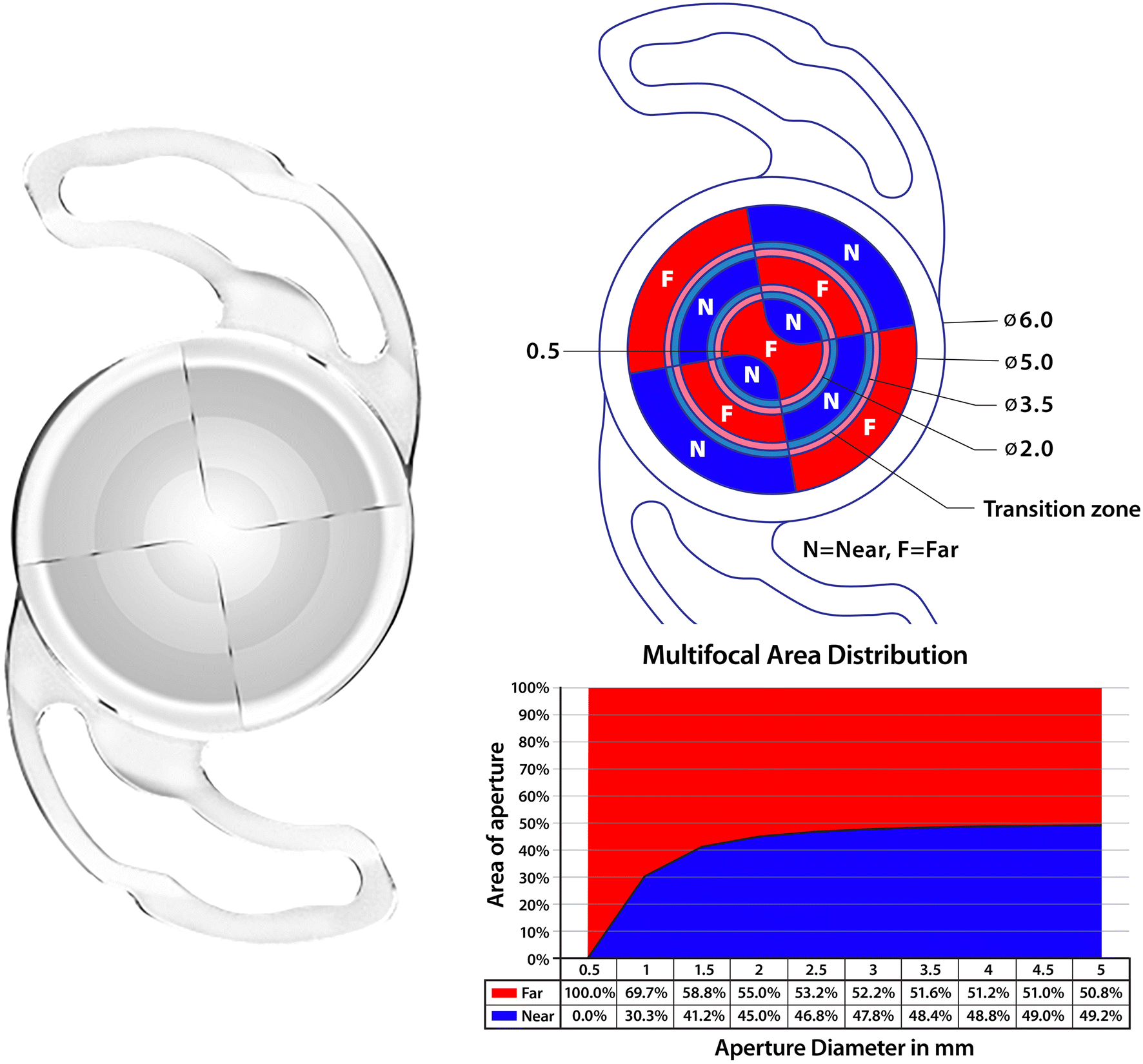 Continuous Transitional Focus (CTF): A New Concept in Ophthalmic ...