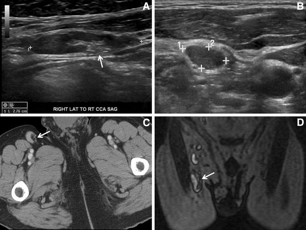 Radiologic Assessment of Lymph Nodes in Oncologic Patients | SpringerLink