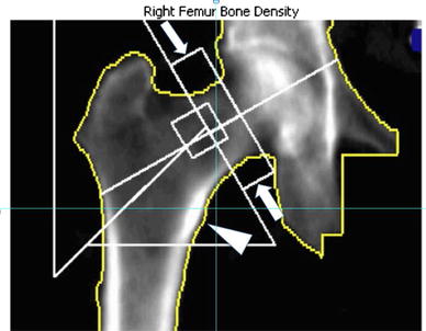 A Practical Approach to Interpretation of Dual-Energy X-ray ...
