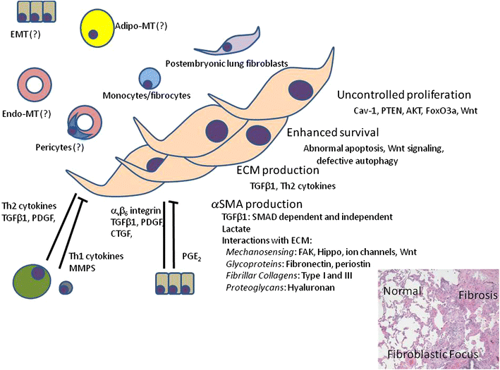 Regulation and Relevance of Myofibroblast Responses in Idiopathic ...
