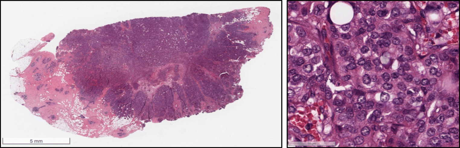The Emergence of Pathomics | SpringerLink