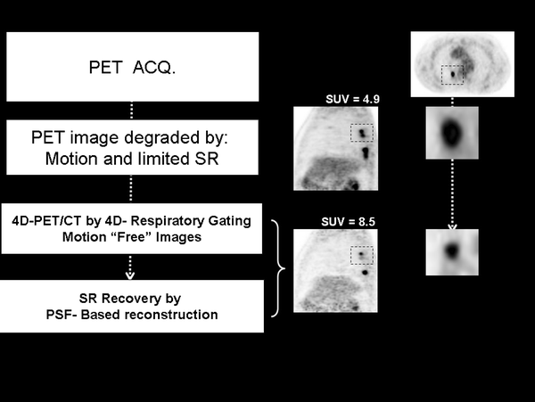 PET quantification: strategies for partial volume correction | SpringerLink