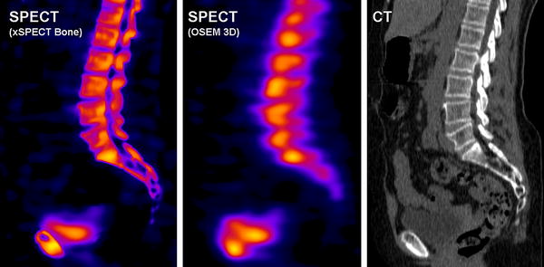 SPECT/CT technology | SpringerLink