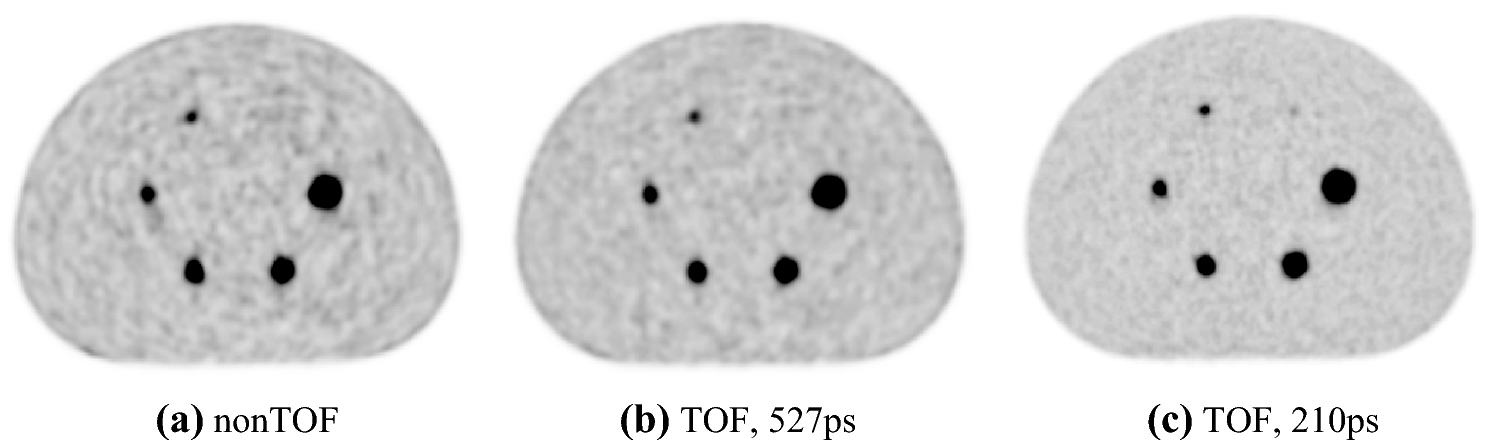 The new opportunities for high time resolution clinical TOF PET ...