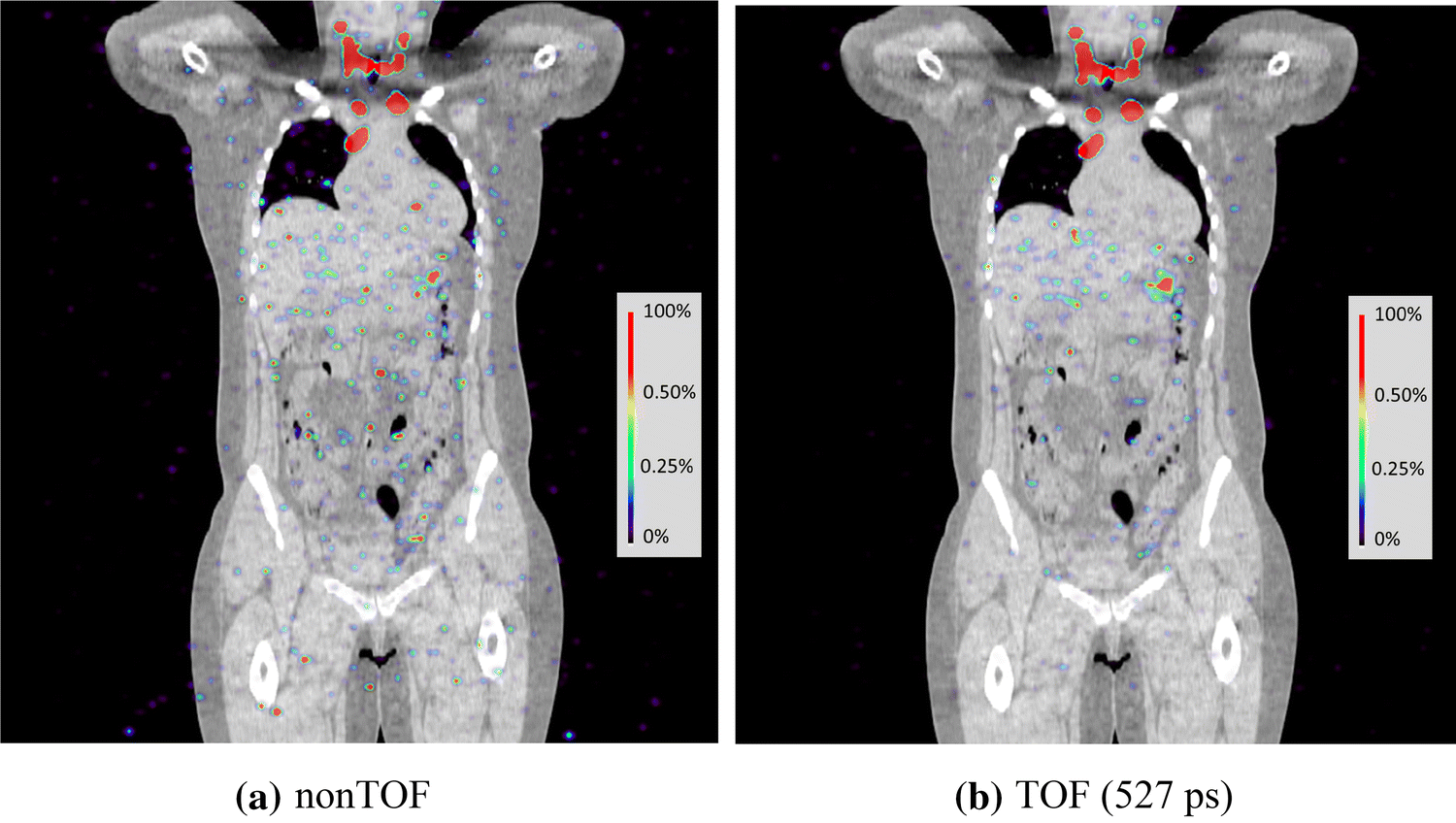 The new opportunities for high time resolution clinical TOF PET ...