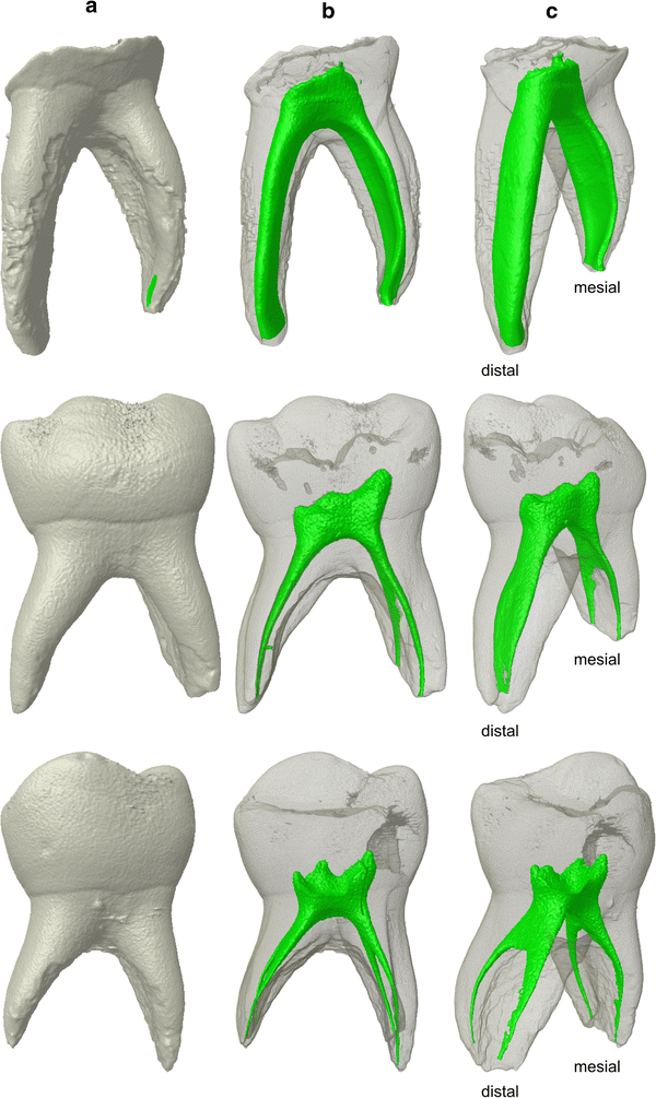 Root canal morphology of primary molars: a micro-computed tomography ...