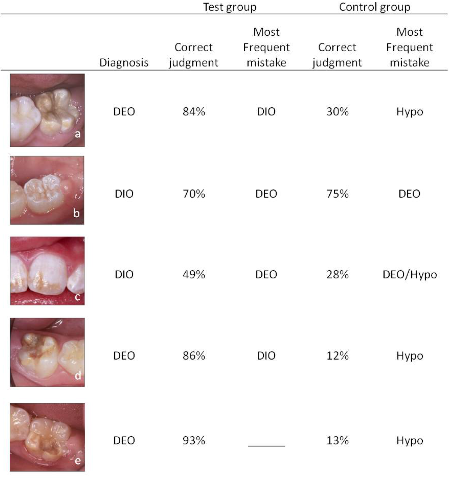 Difficulties in identifying developmental defects of the enamel: a BITA ...