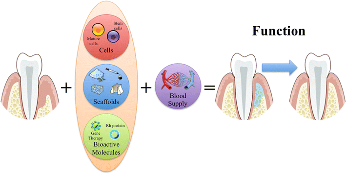 Stem Cells, Scaffolds and Gene Therapy for Periodontal Engineering ...