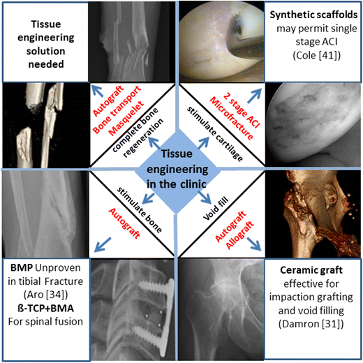 Bone Tissue Engineering | SpringerLink