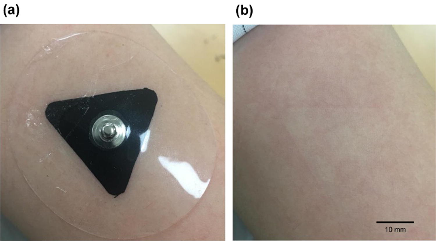 Carbon Nanofiber-Based Wearable Patches for Bio-Potential Monitoring ...