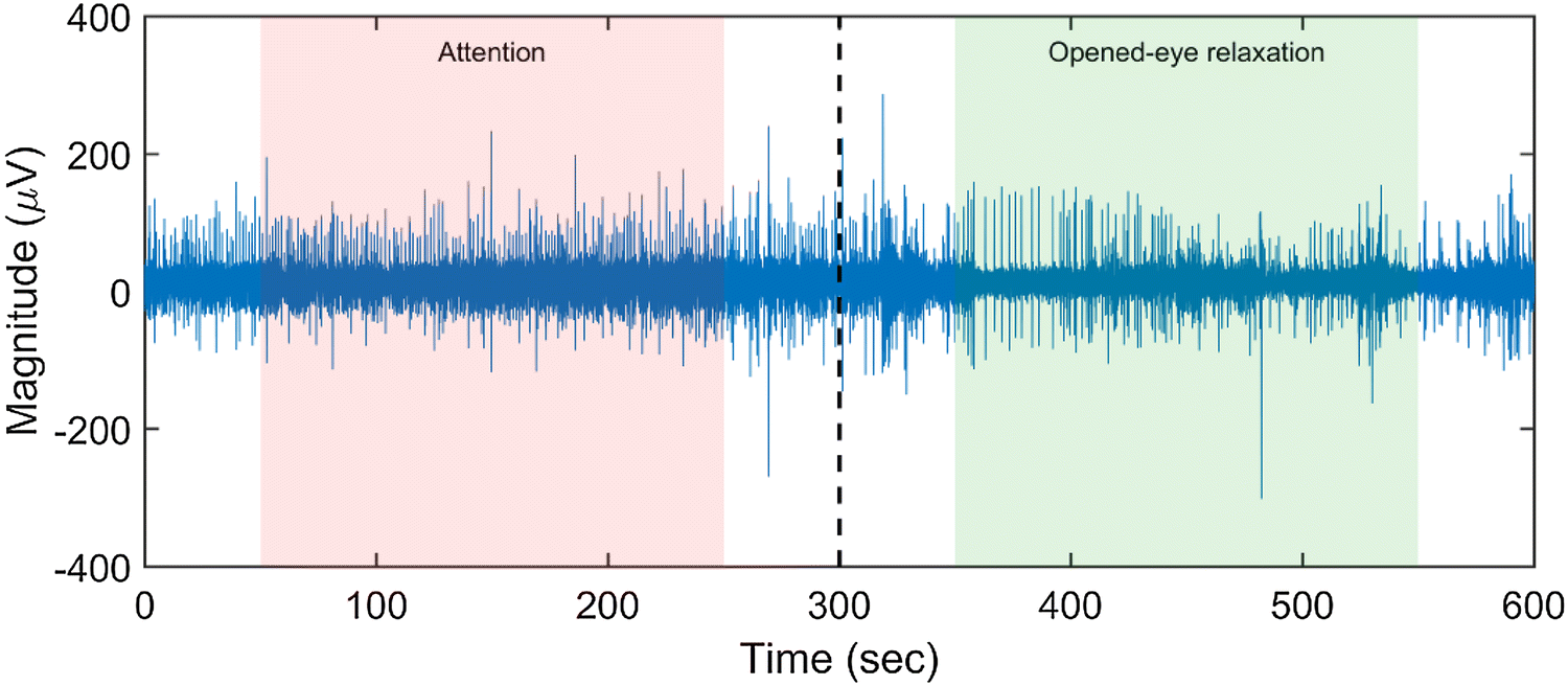 An EEG-Based Attentiveness Recognition System Using Hilbert–Huang Transform and Support Vector ...