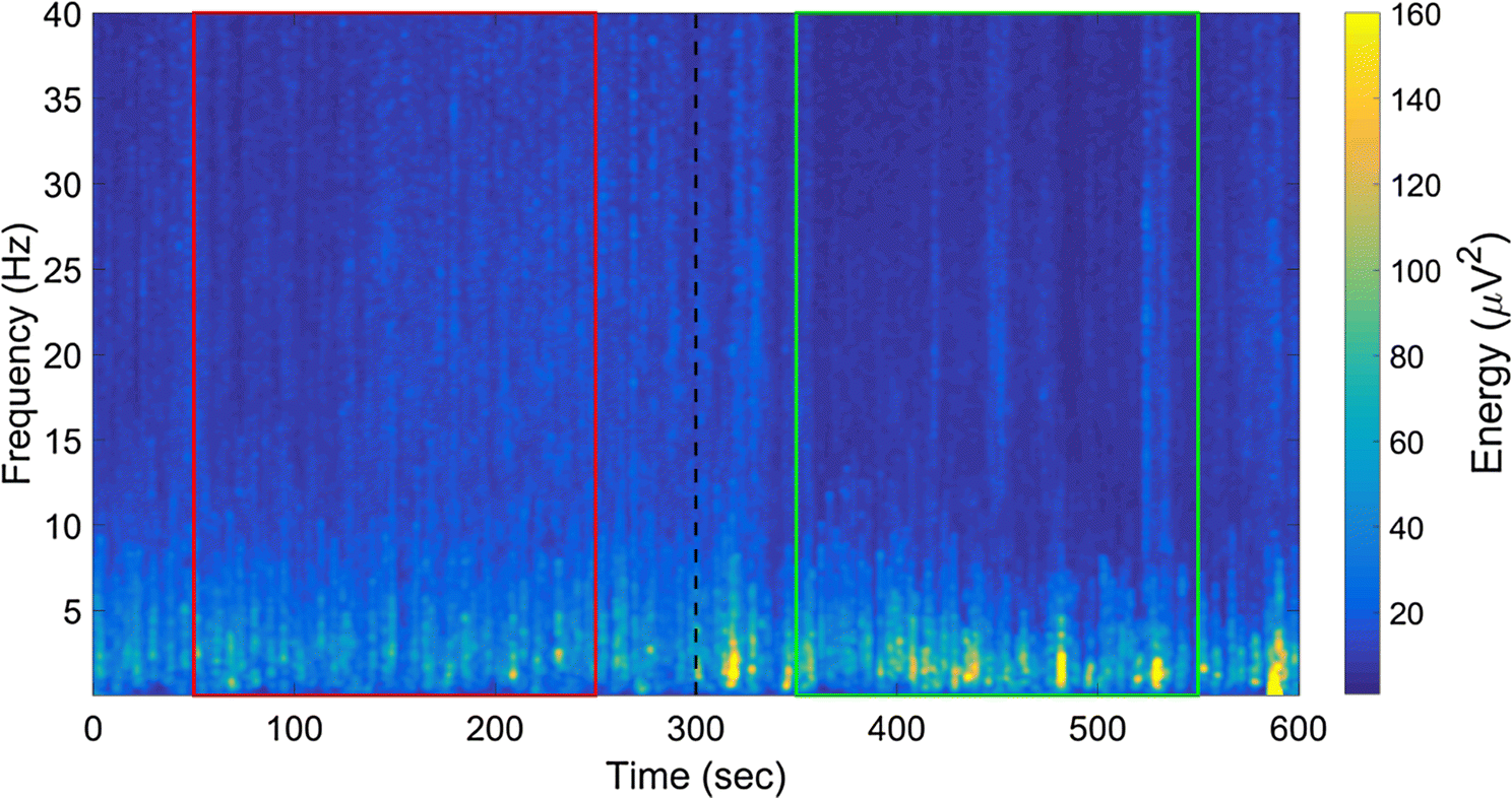 An EEG-Based Attentiveness Recognition System Using Hilbert–Huang Transform and Support Vector ...