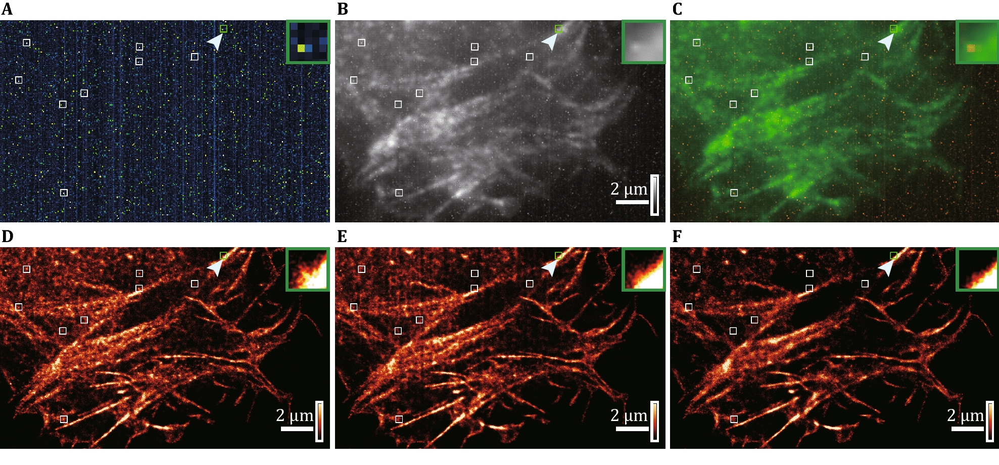 Hessian single-molecule localization microscopy using sCMOS camera | SpringerLink