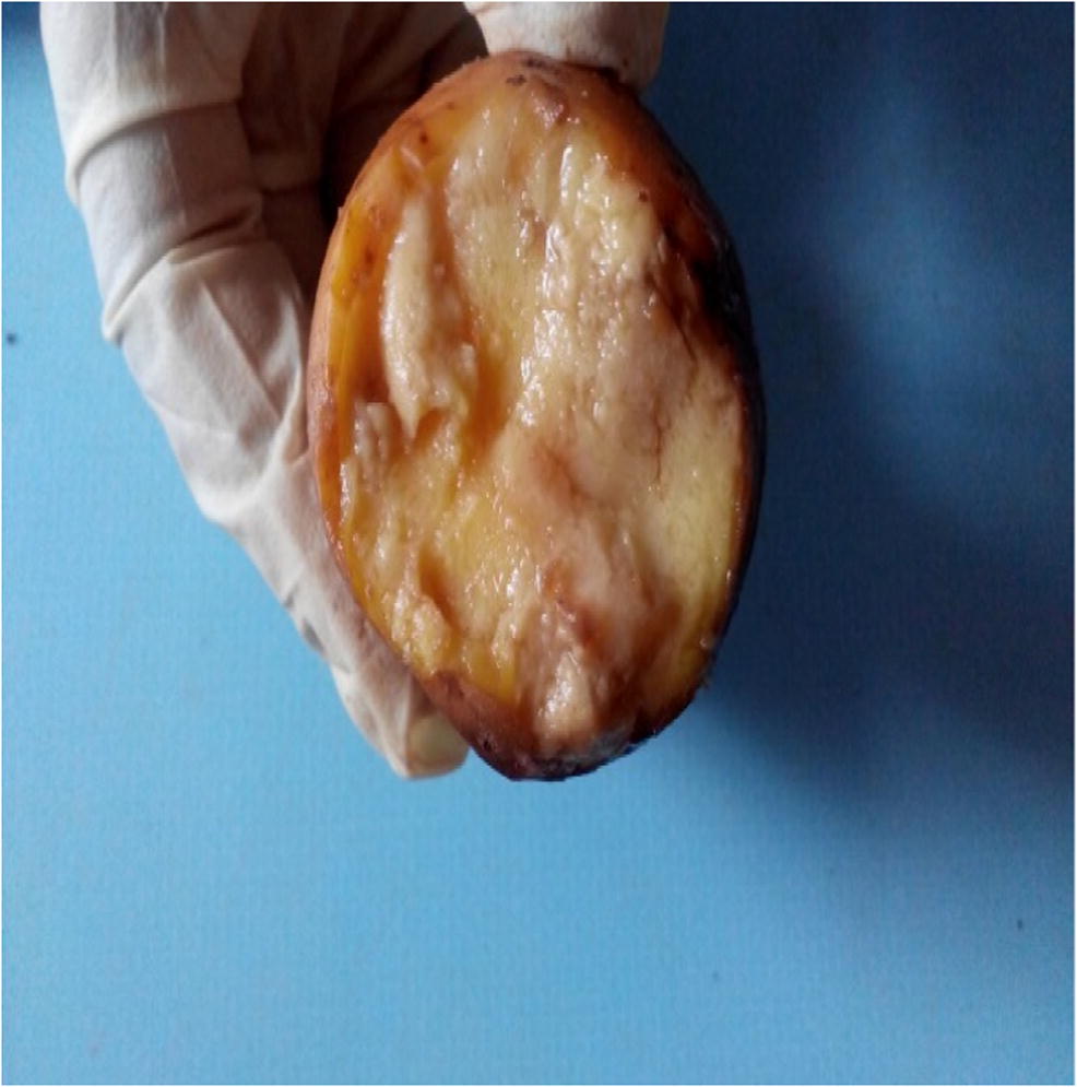 Occurence of pectinolytic bacteria causing blackleg and soft rot of ...