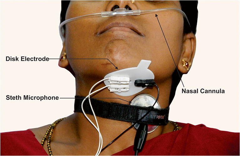 The Effect of Chin-Down Position and Bolus Volume on Swallow-Induced ...