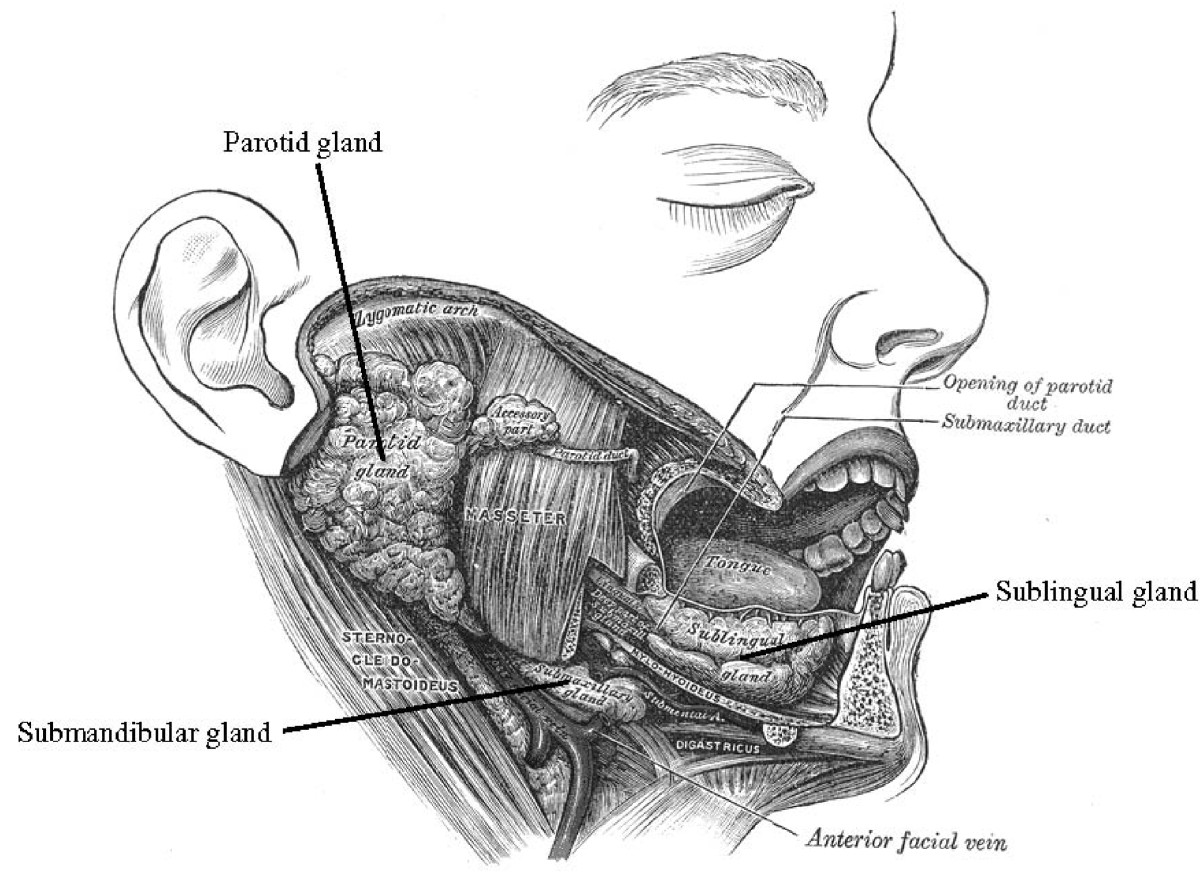 An Overview Of The Rare Parotid Gland Cancer Springerlink