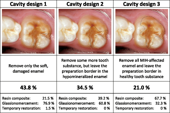 Treatment decisions on Molar-Incisor Hypomineralization (MIH) by ...