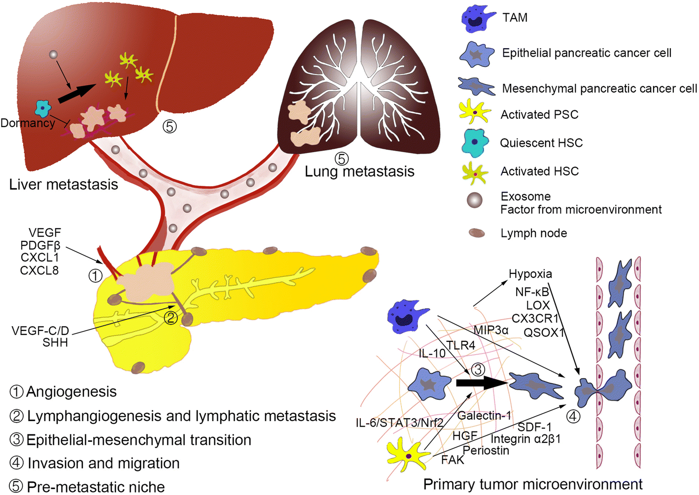 Tumor microenvironment participates in metastasis of pancreatic cancer ...