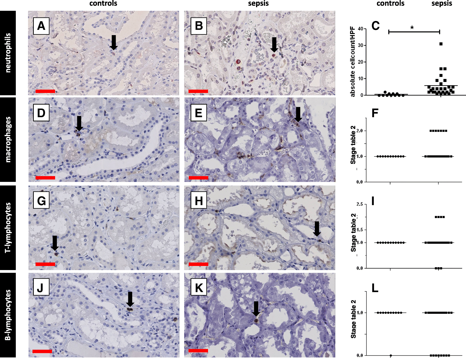 Kidney histopathology in lethal human sepsis | SpringerLink