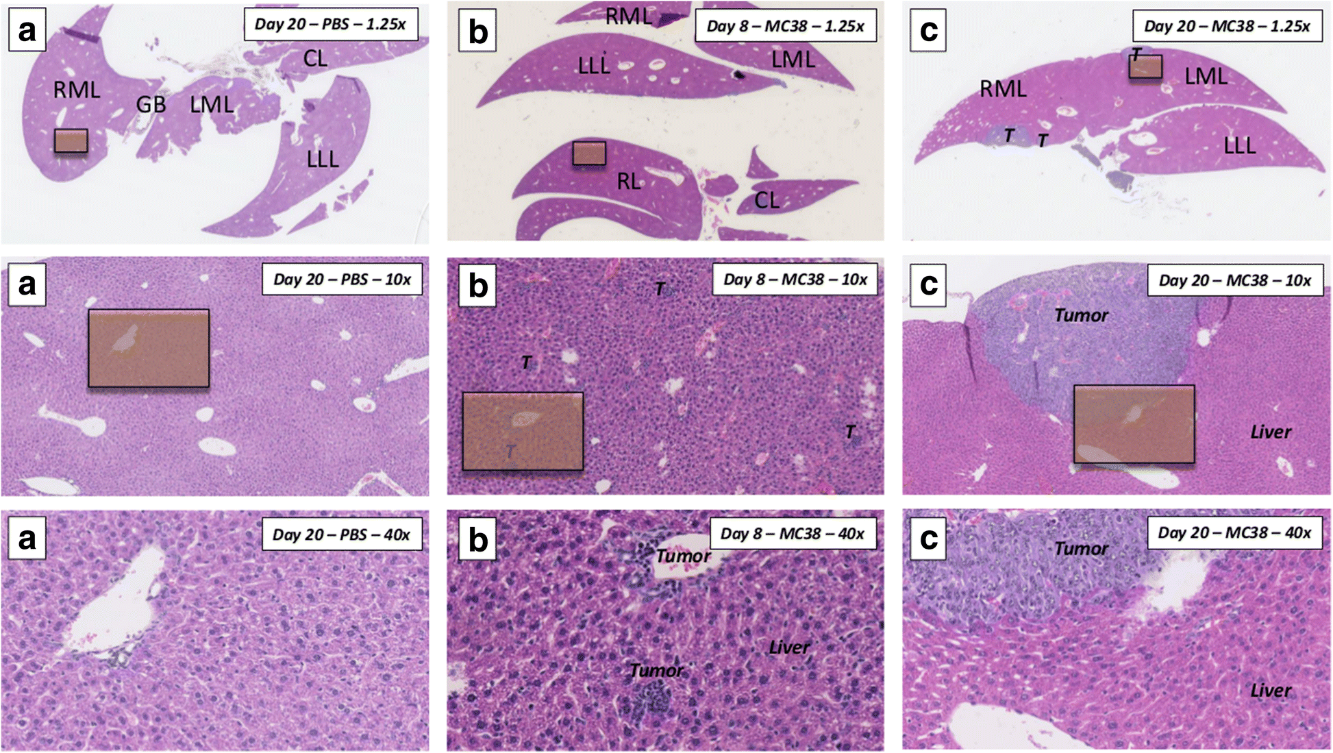 Radiomics of liver MRI predict metastases in mice | SpringerLink