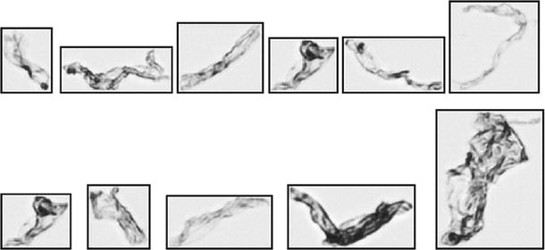 Micro-Flow Imaging: Flow Microscopy Applied to Sub-visible Particulate ...