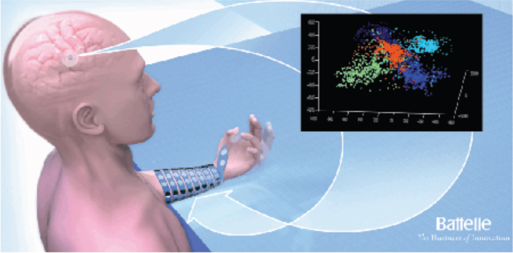 Neural Decoding and Applications in Bioelectronic Medicine | SpringerLink