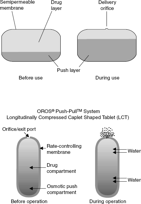 Gastrointestinal Safety of an Extended-Release, Nondeformable, Oral ...