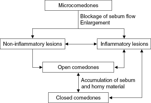 Current Concepts of the Pathogenesis of Acne | SpringerLink