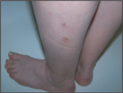 Rowing Injuries | SpringerLink