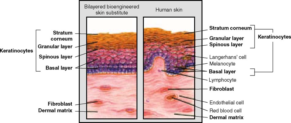 Bilayered Bioengineered Skin Substitute (Apligraf®) | SpringerLink