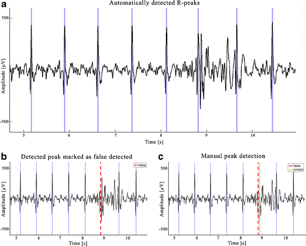ARTiiFACT: a tool for heart rate artifact processing and heart rate ...