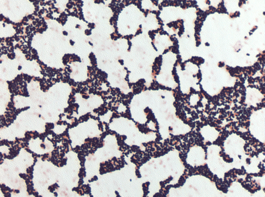 Non contiguous-finished genome sequence and description of Cellulomonas ...