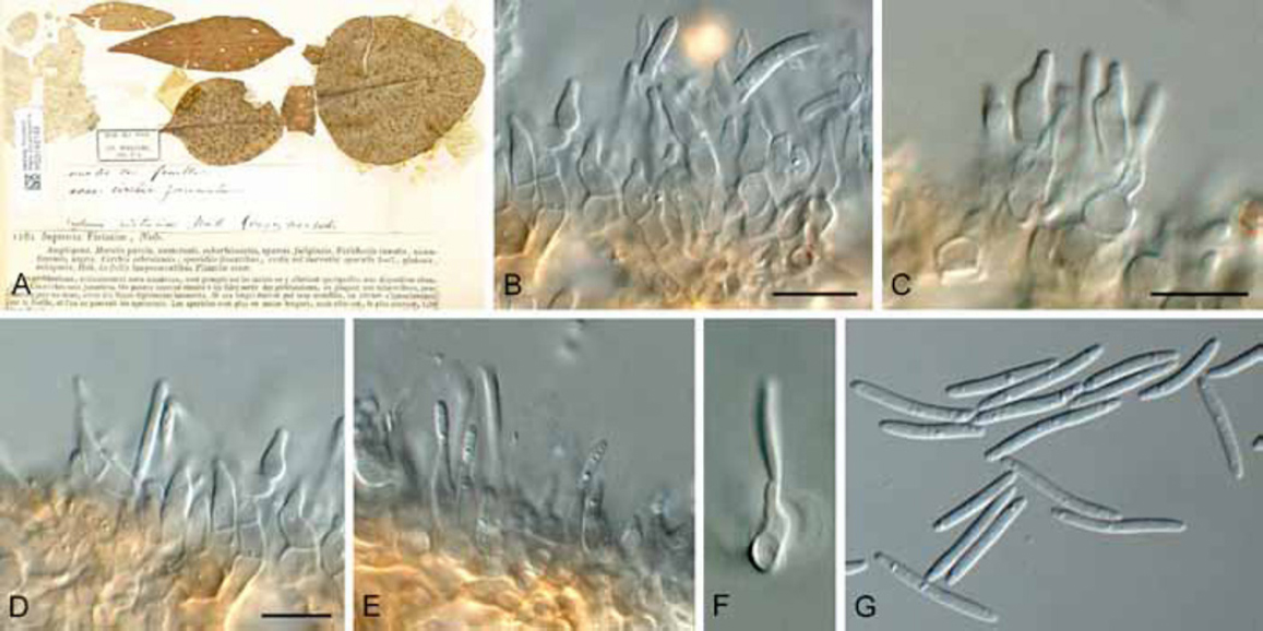 Septoria-like pathogens causing leaf and fruit spot of pistachio ...