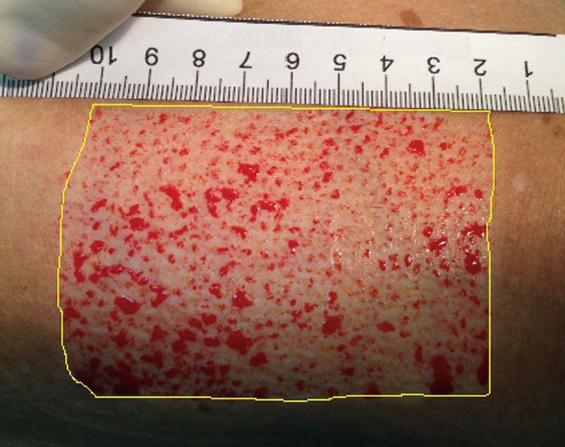 Traditional and Nontraditional Evaluation of Wound Healing Process ...