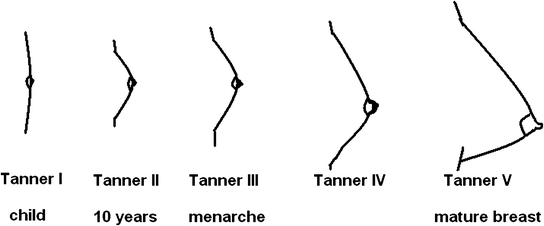 Breast Disorders | SpringerLink