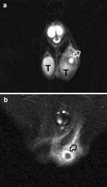 Scrotal Anatomy at MRI | SpringerLink