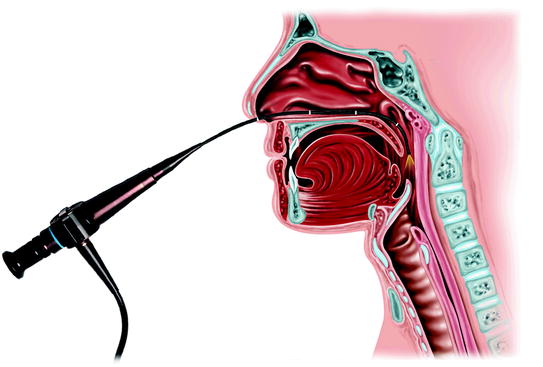 Clinical and Endoscopic Examination of the Head and Neck | SpringerLink