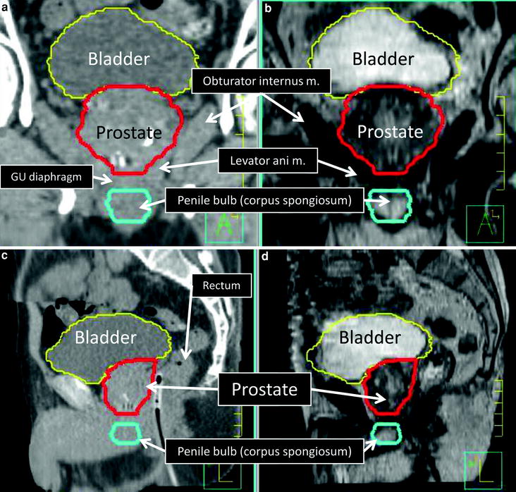 Prostate | SpringerLink