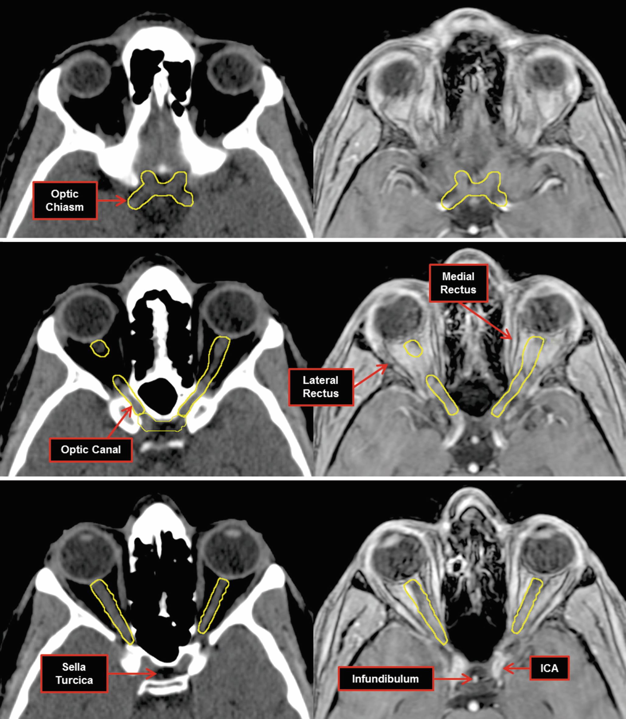 Cranial Nerves | SpringerLink