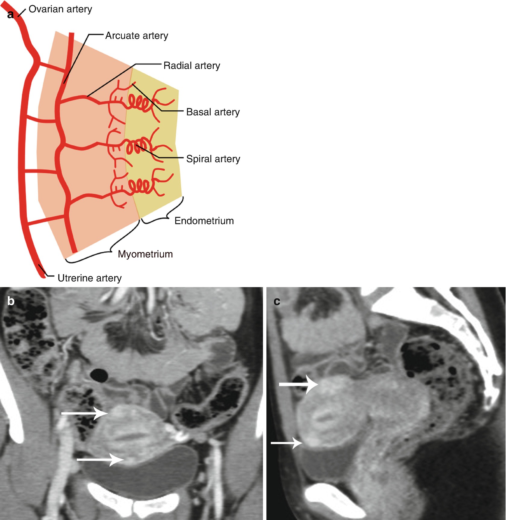 Uterus: Normal Findings | SpringerLink