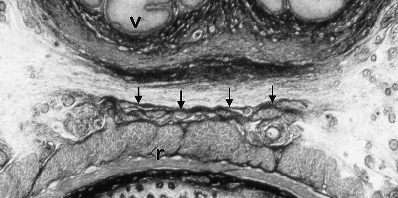 Clinical Anatomy of the Female Pelvis | SpringerLink