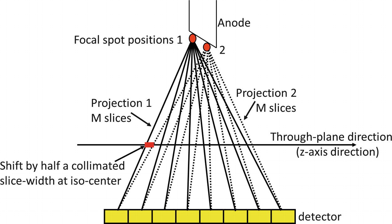 Z Flying Focal Spot Technique 102 Best Miles And Points stories ...