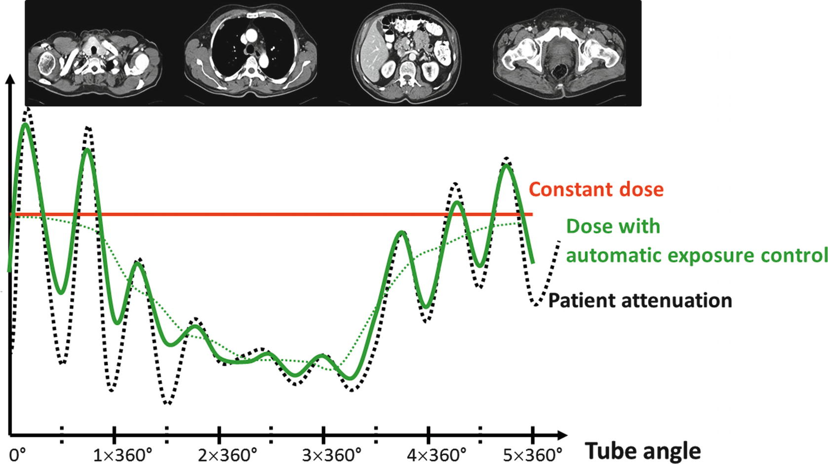 Multi-slice CT: Current Technology and Future Developments | SpringerLink