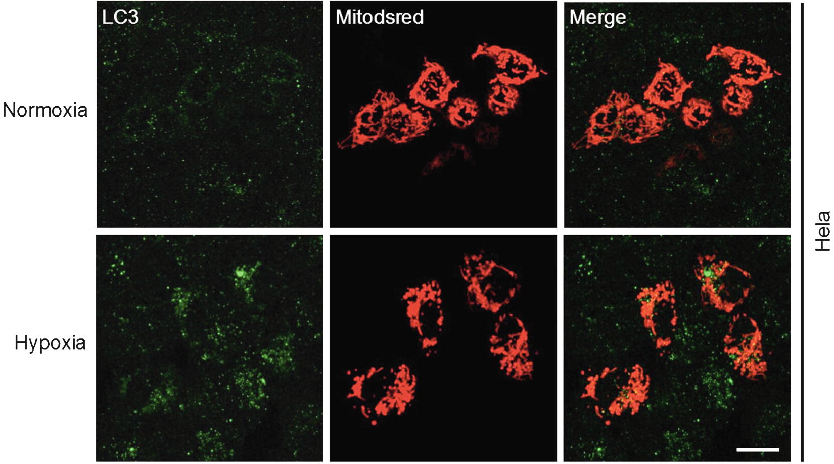 Immunofluorescence Staining Protocols for Major Autophagy Proteins ...